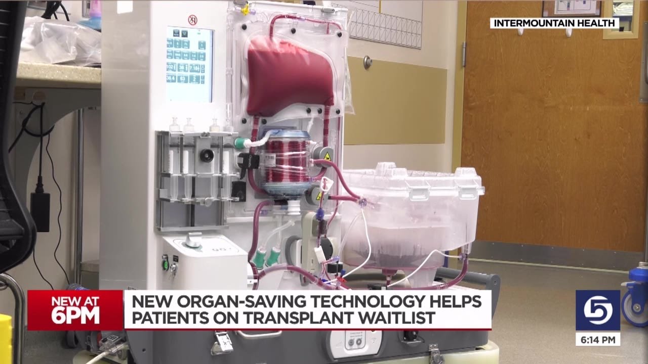 Video: New organ-saving technology helps patients on transplant ...