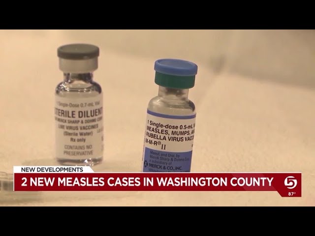 Video: Two more measles cases confirmed in Washington County - KSLTV.com